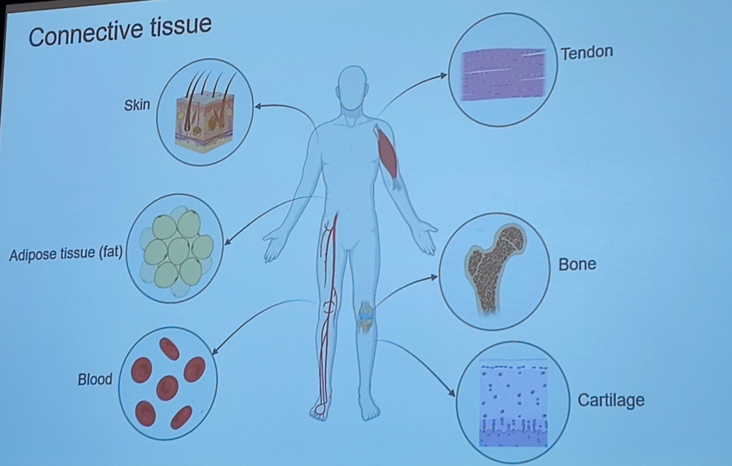 Mrs Aude Beyens, MD (Ghent, Belgium): Structural defects of Connective ...